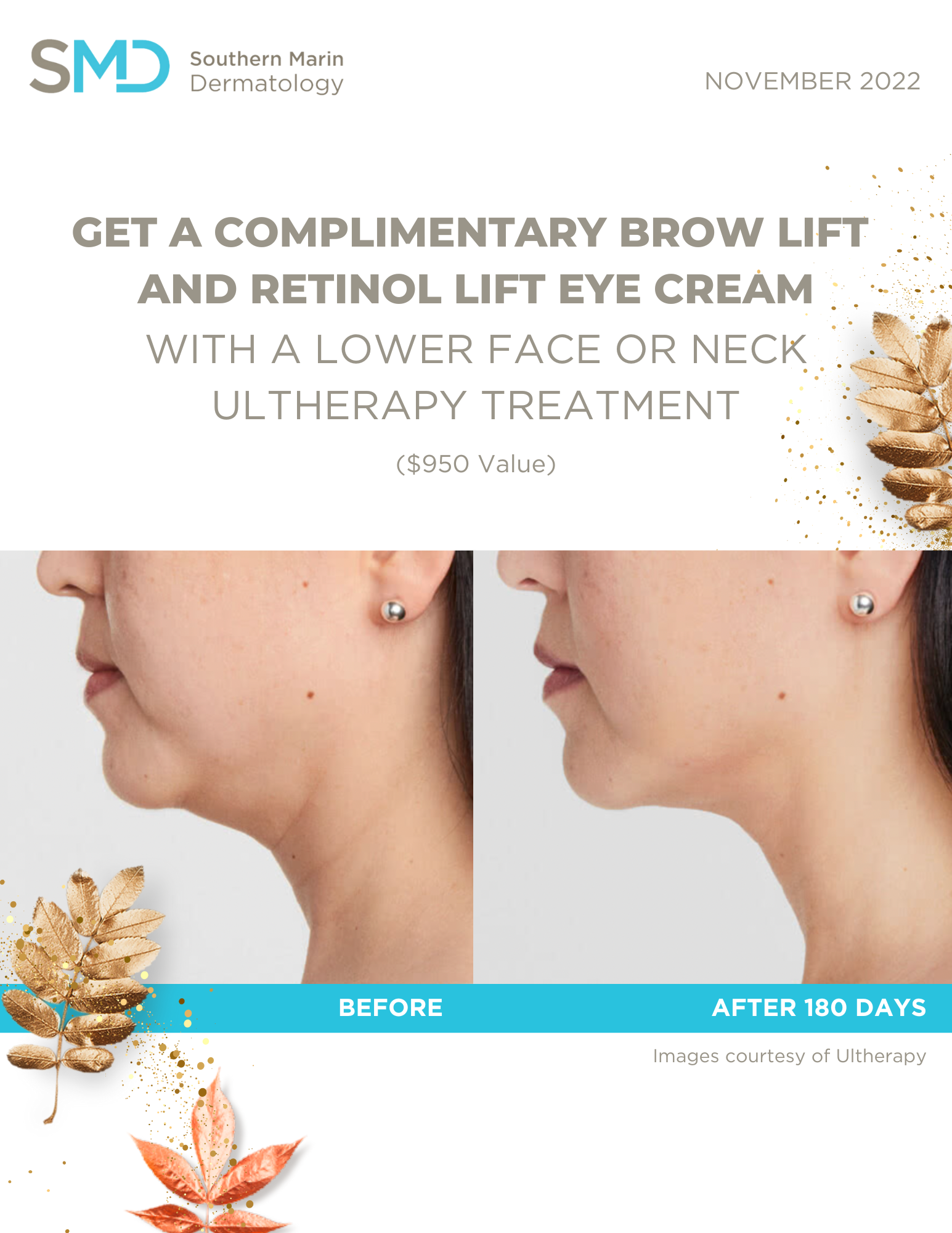 November Promotions 2022 - Southern Marin DermatologySouthern Marin ...